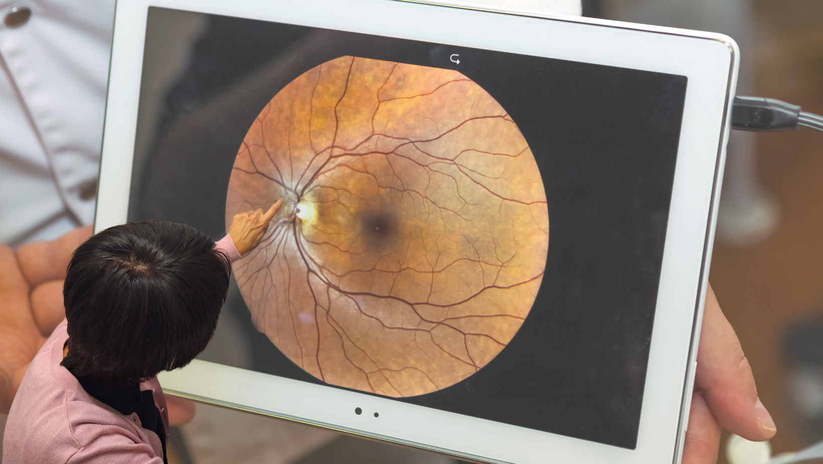 What Your Retina Reveals: The Power of Fundus Photography | Vision Corner